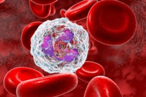 Ganglion sous l’aisselle : causes, durée, quand consulter